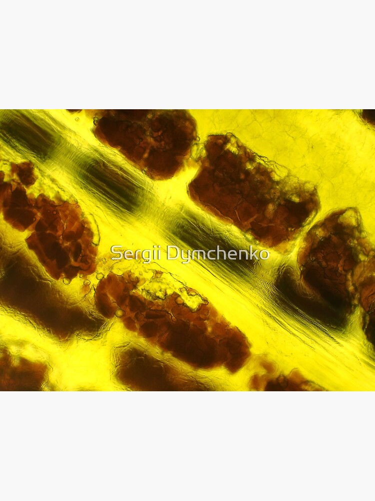 "Banana peel under the microscope" Poster by sdymchenko | Redbubble