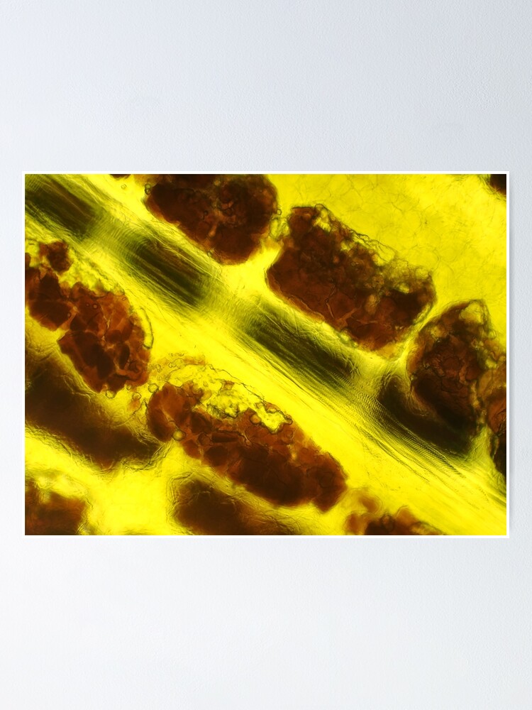 "Banana peel under the microscope" Poster by sdymchenko | Redbubble