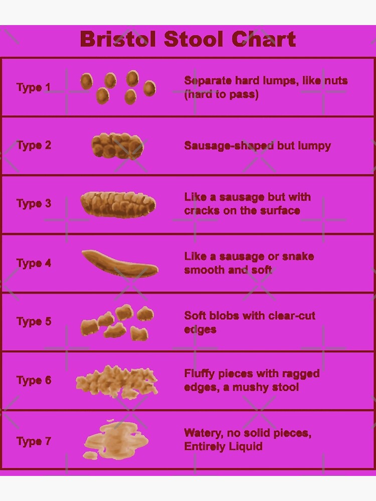 "Bristol Stool Chart Scale" Poster by AlexMooren | Redbubble
