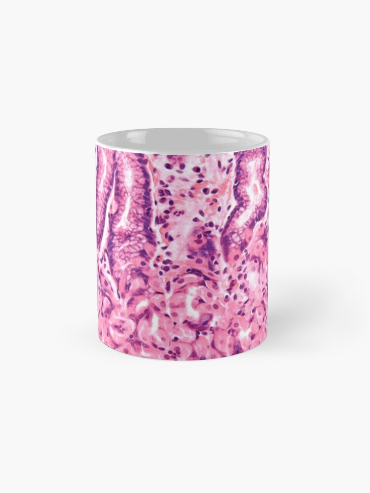 "Stomach Histology" Coffee Mug for Sale by deltoid | Redbubble