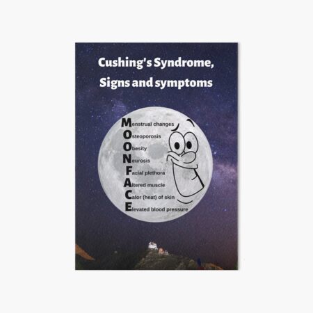 "Cushing's Syndrome, Signs and Symptoms: MOON FACE Mnemonic" Art Board ...