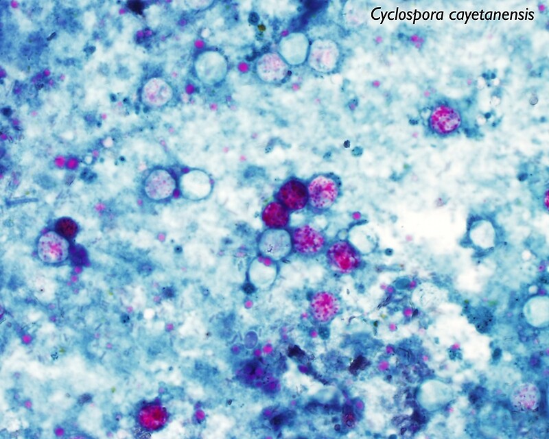"Cyclospora cayetanensis" by Bobbi Pritt | Redbubble