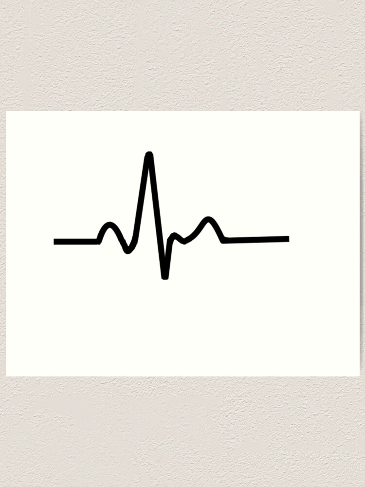 "ECG Trace" Art Print for Sale by nearlyadoctor | Redbubble