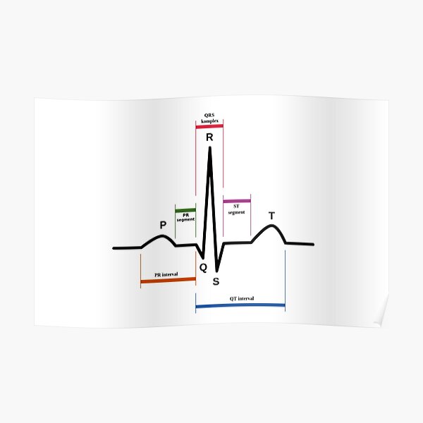 " Cardiology Ecg " Poster for Sale by MEDICALDREAM | Redbubble