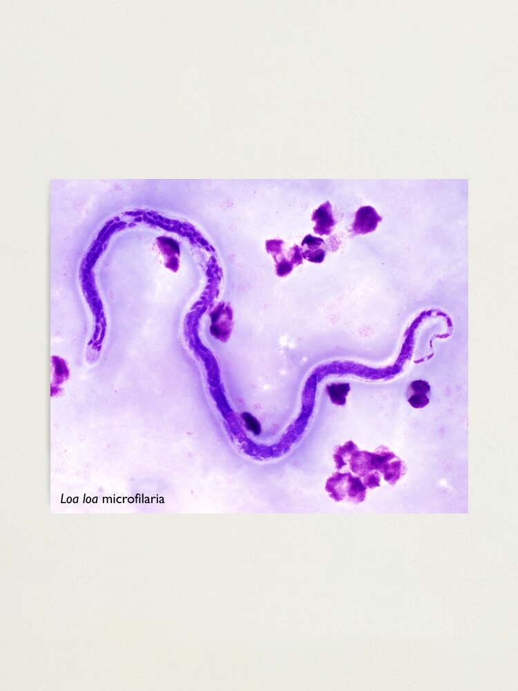 "Loa loa microfilaria" Photographic Print for Sale by bpritt | Redbubble