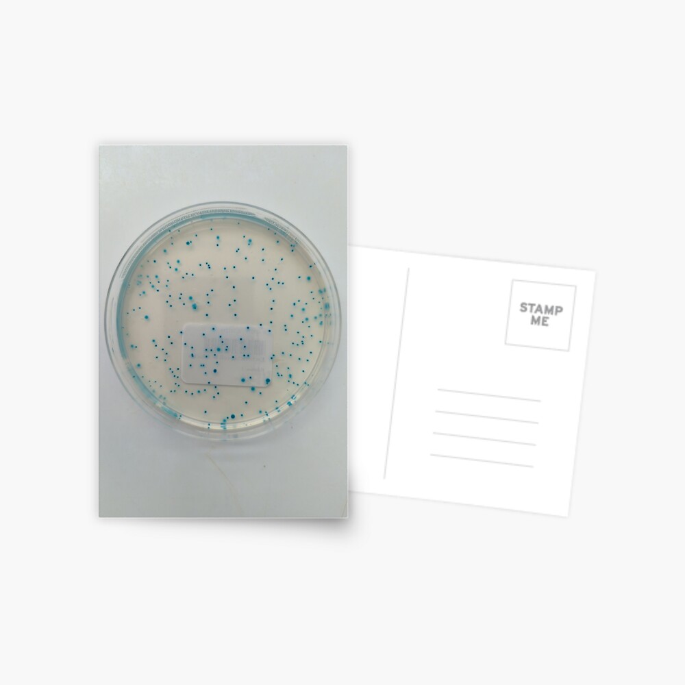 "E.coli on TBX plate" Sticker for Sale by fromthelab | Redbubble