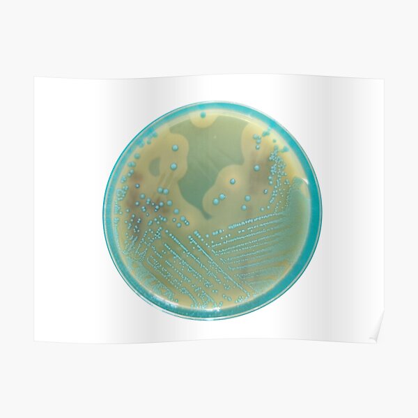 "Listeria growing an ALOA agar" Poster for Sale by fromthelab | Redbubble