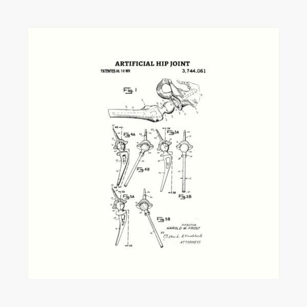 "Artificial Hip 1973 Patent , Prosthetic hip Patent Artificial hip ...