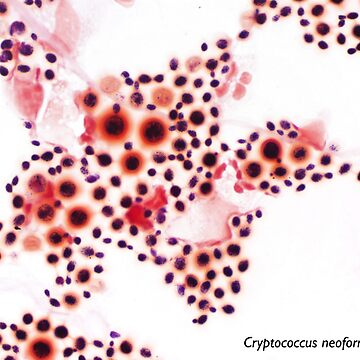Lámina fotográfica for Sale con la obra «Cryptococcus neoformans» de ...