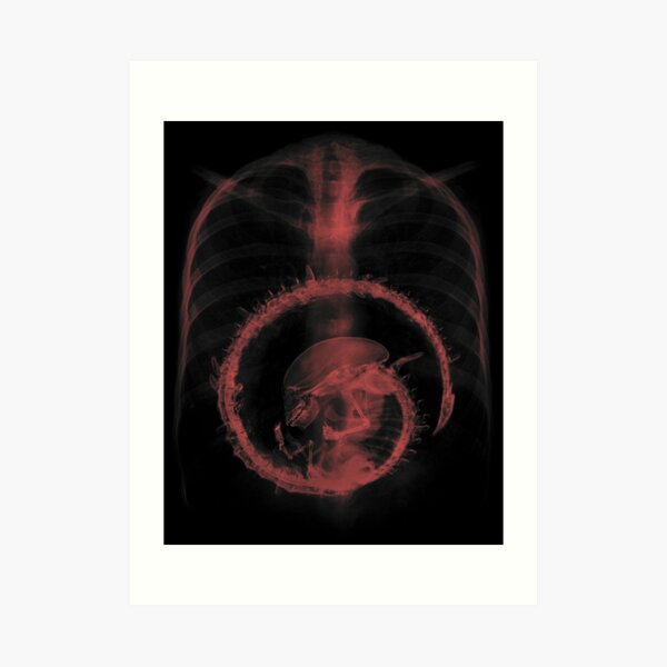 "Alien radiography v2, Alien X-ray v2, red" Art Print for Sale by ...