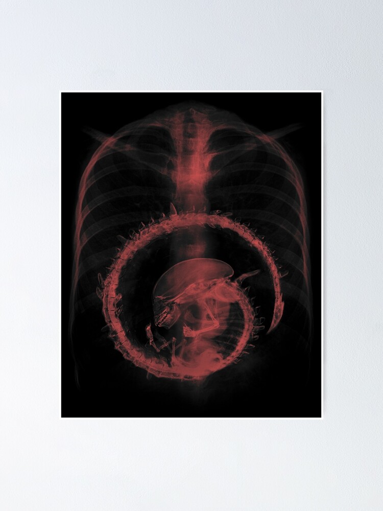 "Alien radiography v2, Alien X-ray v2, red" Poster by Arturo Vivó ...