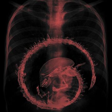 "Alien radiography v2, Alien X-ray v2, red" Poster by Arturo Vivó ...