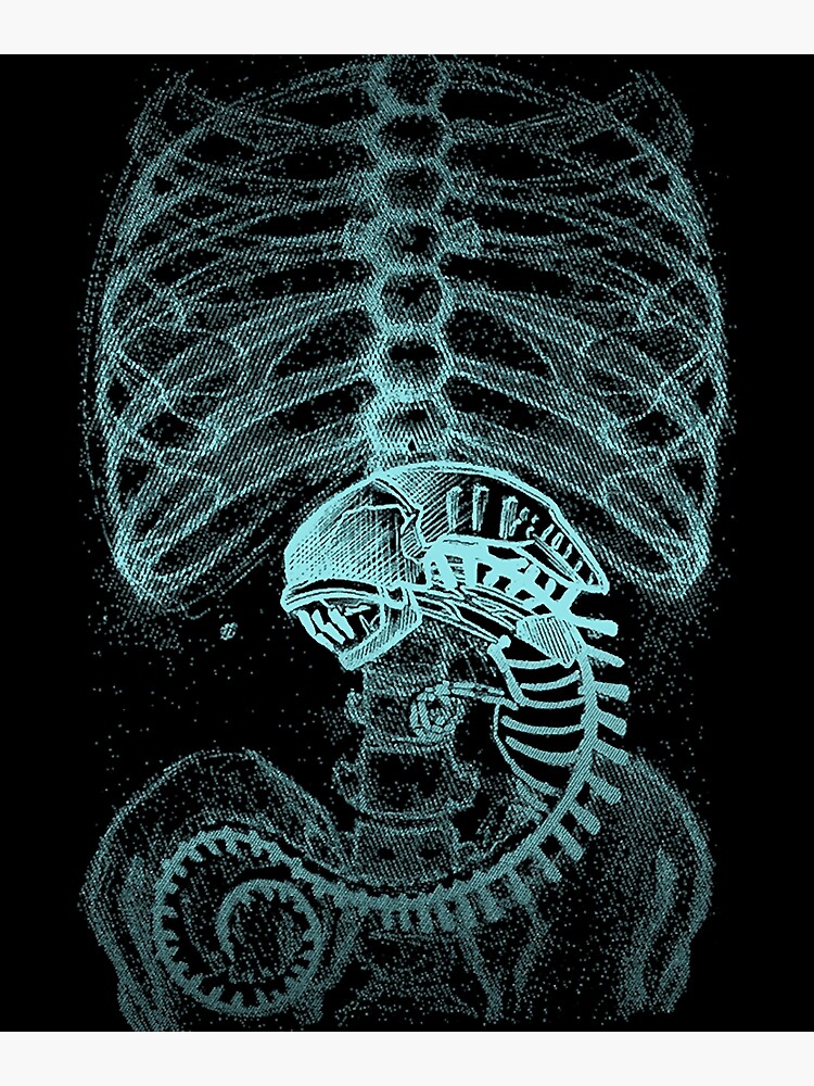 "Alien Radiography X-Ray " Poster for Sale by WayneBol | Redbubble