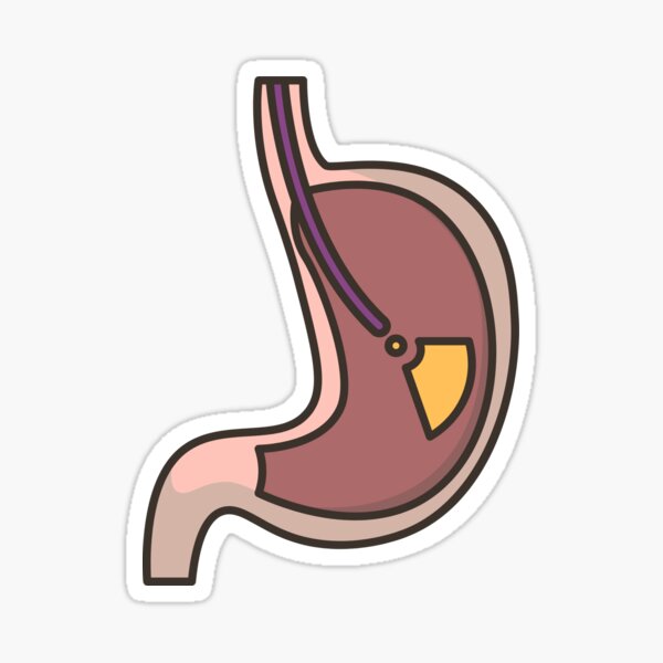 "endoscopy" Sticker for Sale by AyahBaniMustafa | Redbubble