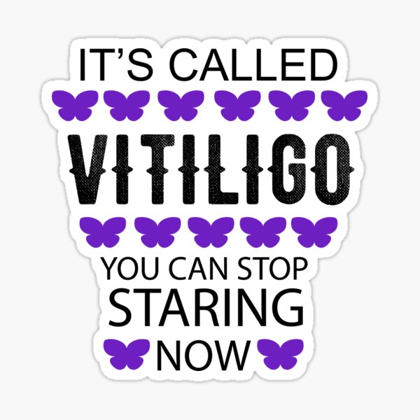 "It's called Vitiligo you can stop staring now - Vitiligo Raise ...