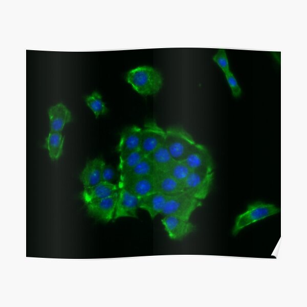 "Neon green cells and blue nuclei" Poster for Sale by ArtByScience ...