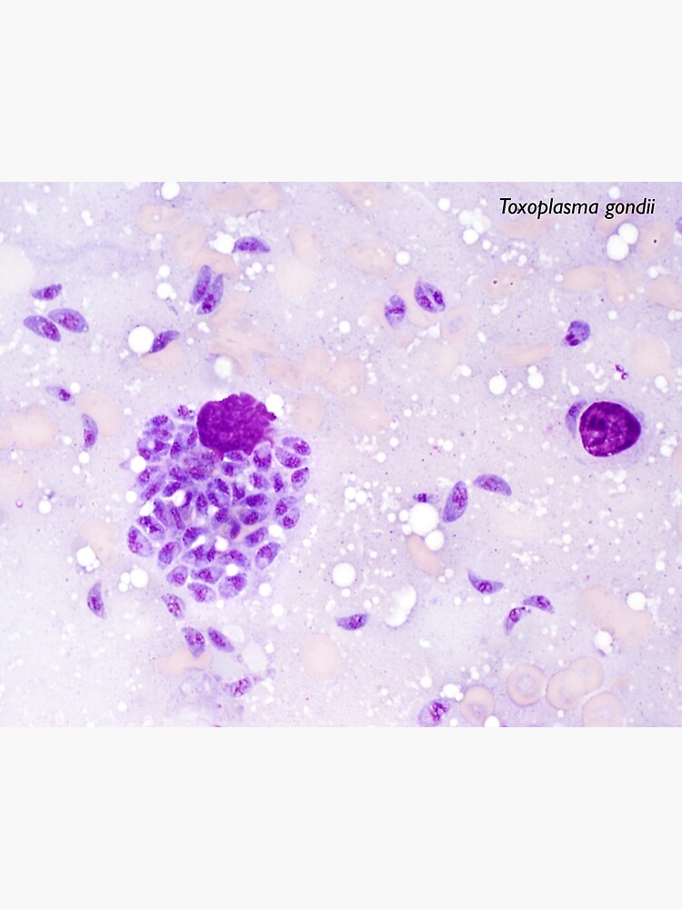 "Toxoplasma gondii" Art Print for Sale by bpritt | Redbubble