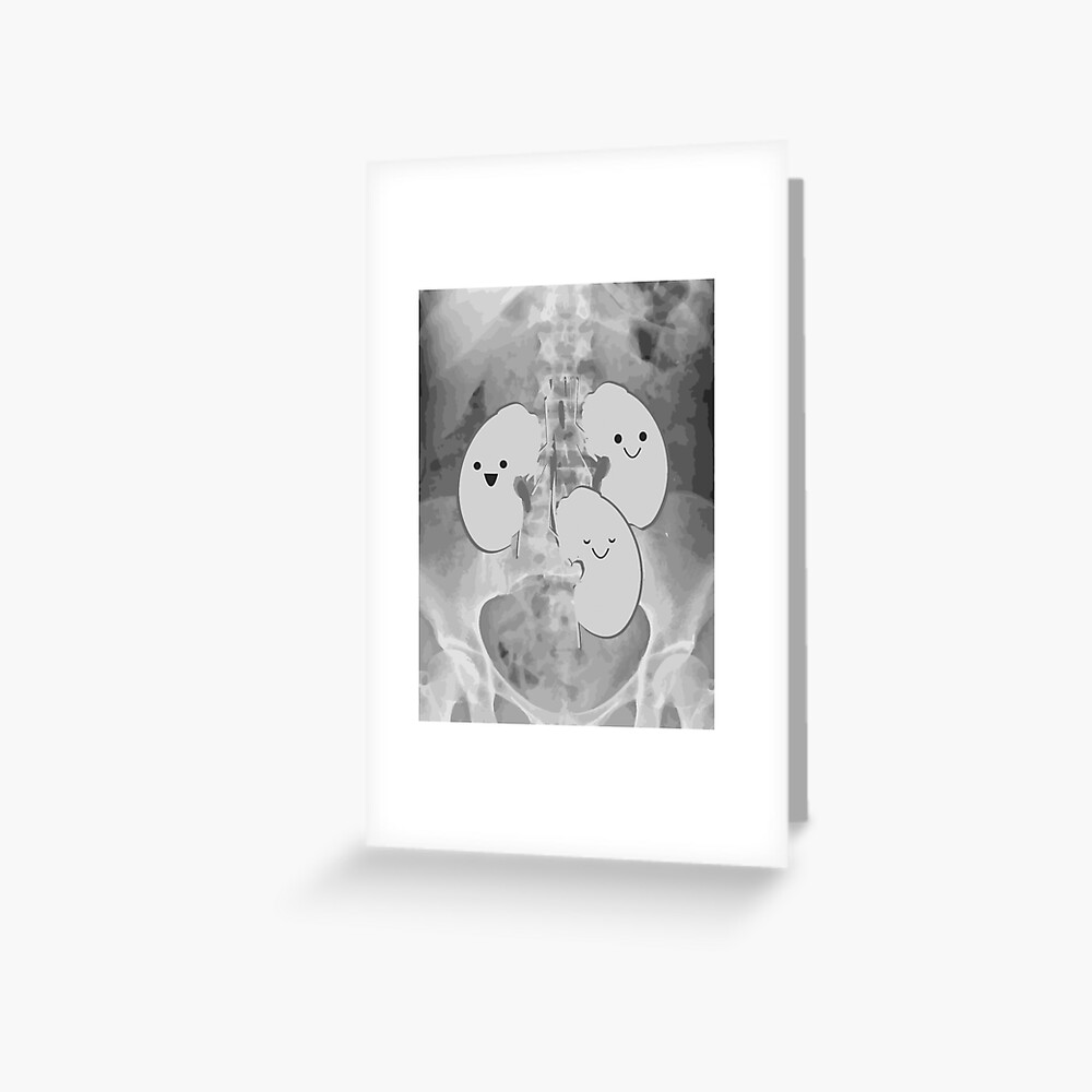 "Kidney Transplant Recipient " Greeting Card for Sale by partsypants ...