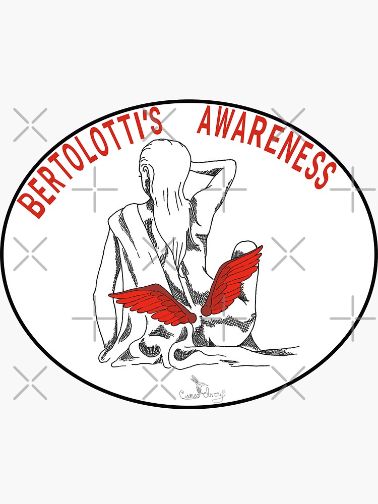 "Bertolotti Syndrome Awareness. " Sticker for Sale by cameoivory ...