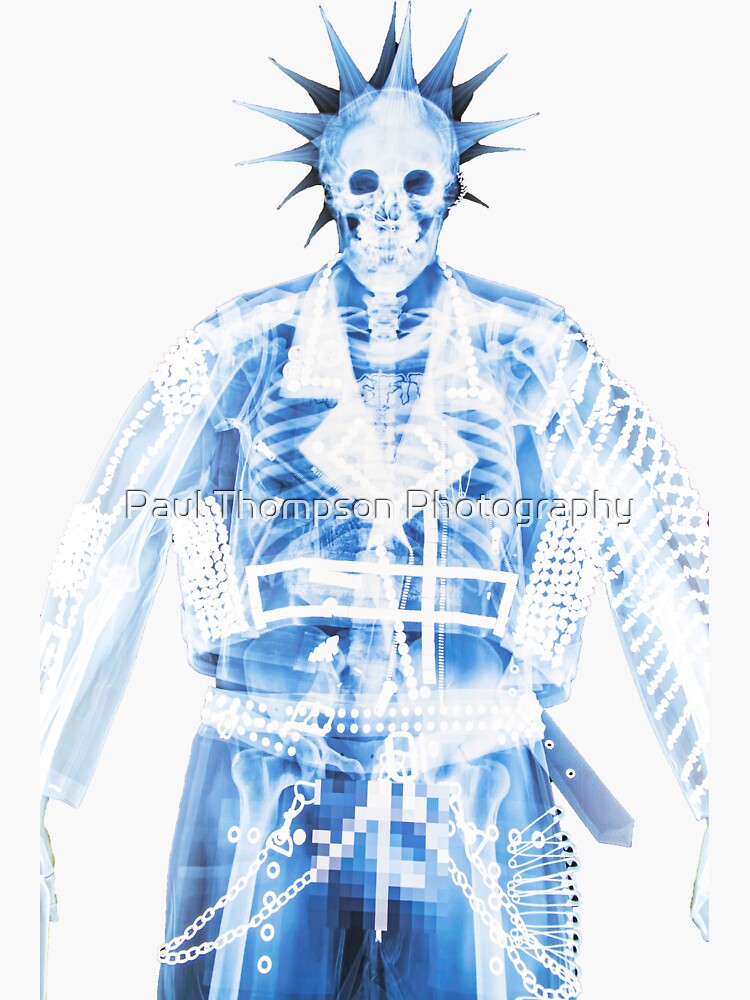 "Punk Rocker X-ray" Sticker for Sale by tommysphotos | Redbubble