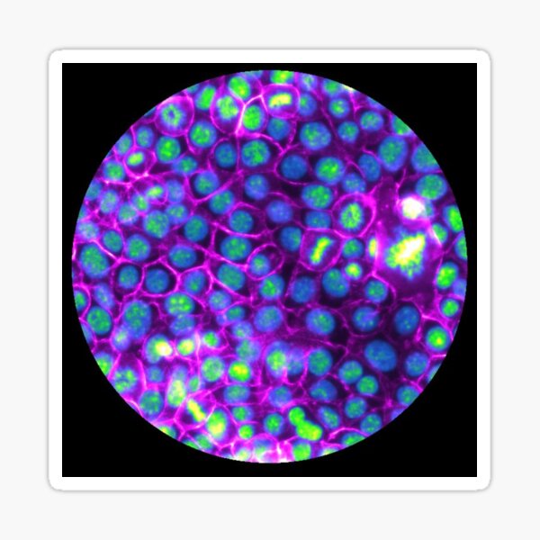 "Membranes and nuclei - neon blue green and pink" Sticker for Sale by ...