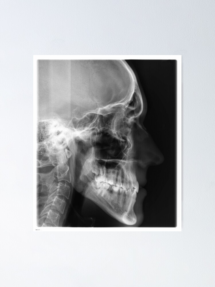 "X-Ray portrait" Poster by Zhirnoff | Redbubble