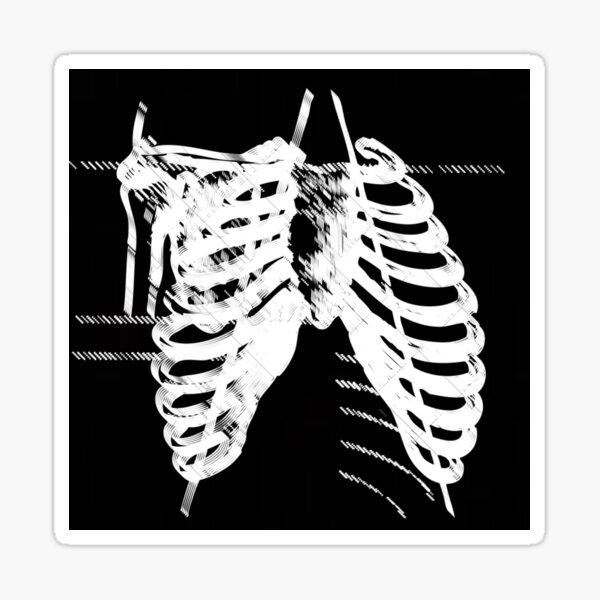 "skeleton chest" Sticker for Sale by Tewqi | Redbubble