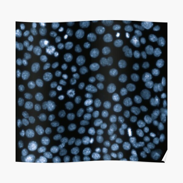 "Cool blue nuclei in epithelial cells. Nature inspired polka-dots ...