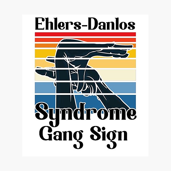 Lámina fotográfica « Síndrome de Ehlers-Danlos Gang Sign EDS HSD» de ...