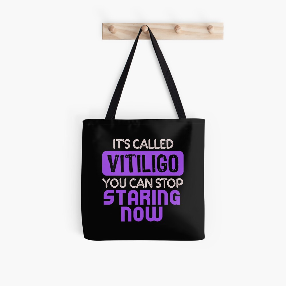 "It's called Vitiligo you can stop staring now - Vitiligo meme" Tote ...