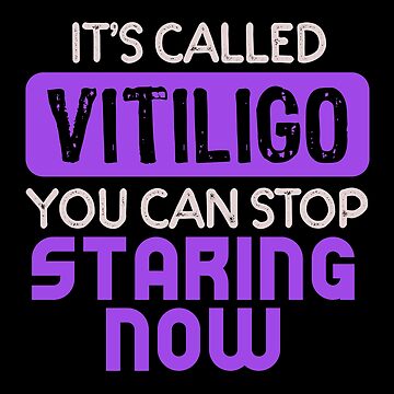 "It's called Vitiligo you can stop staring now - Vitiligo meme" Sticker ...
