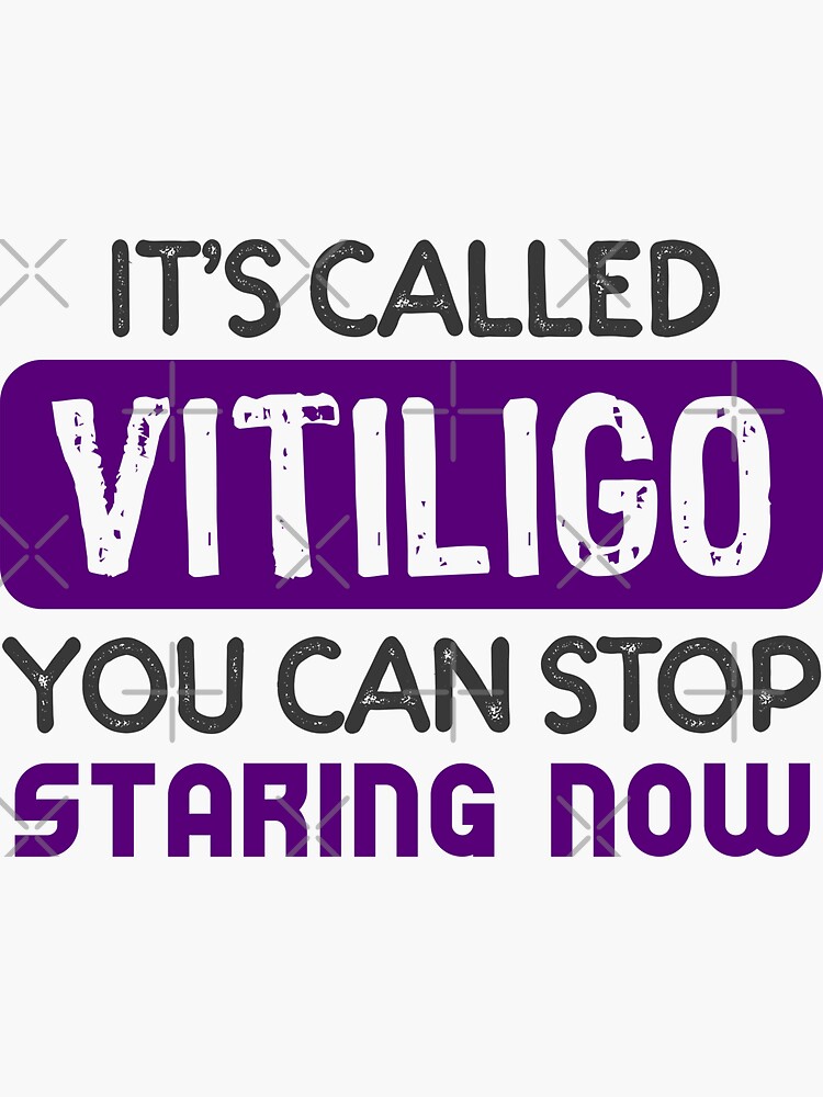 "It's called Vitiligo you can stop staring now - Vitiligo meme" Sticker ...