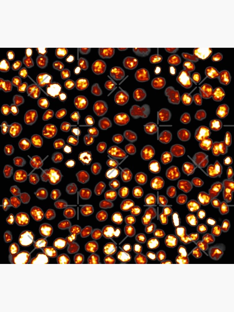 "Gold nuclei in epithelial cells. Express yourself with cellular ...