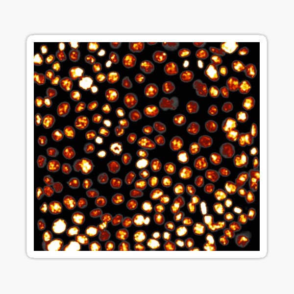 "Gold nuclei in epithelial cells. Express yourself with cellular ...