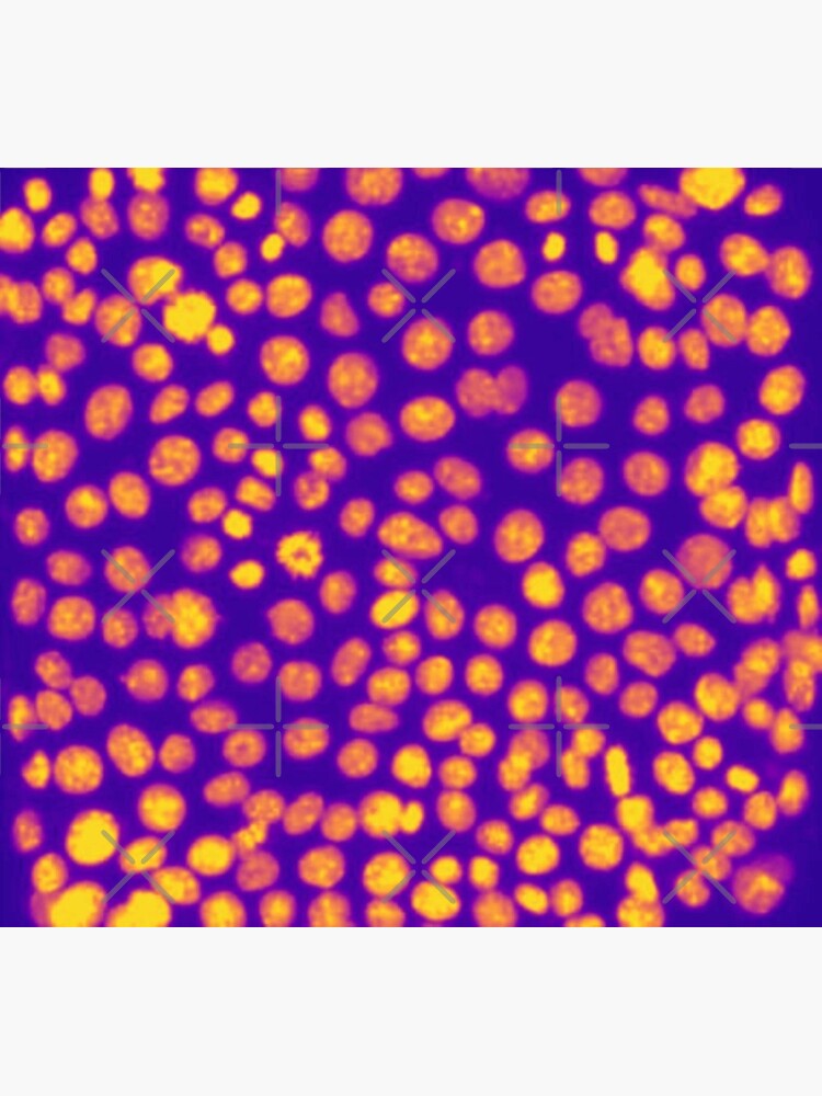 "Orange and purple nuclei in epithelial cells. Express yourself with ...