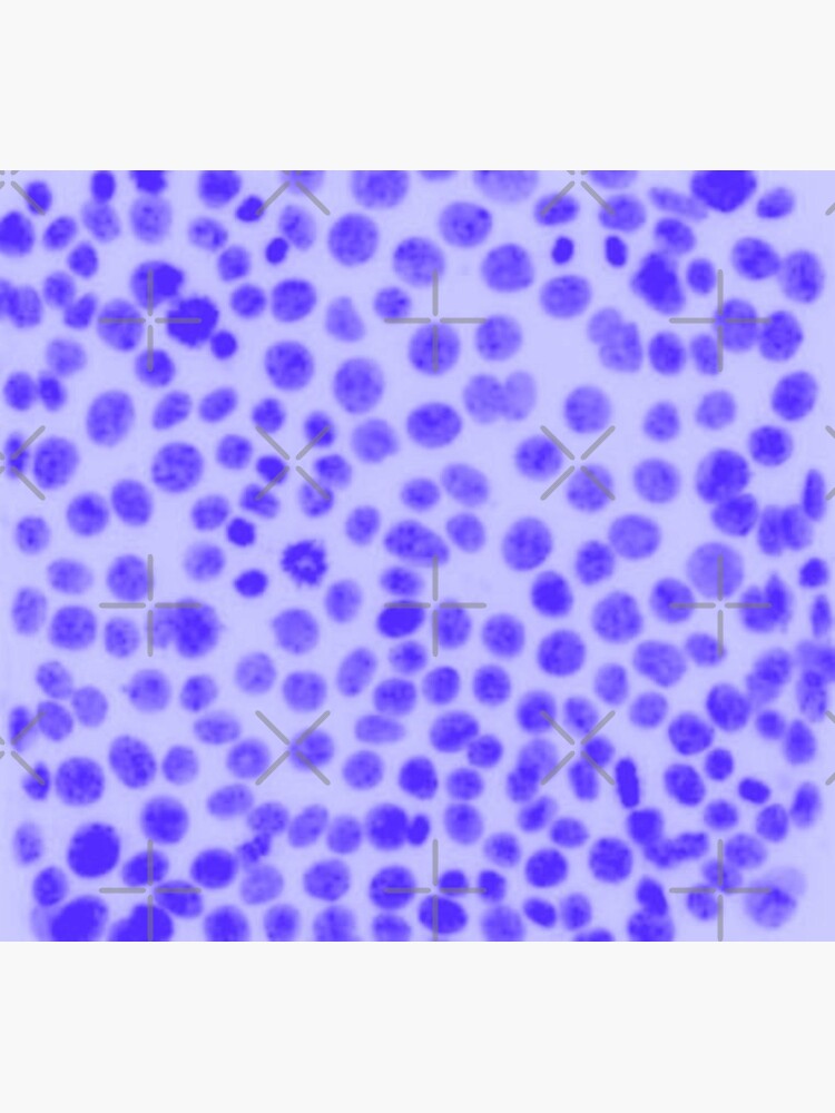 "Pastel purple nuclei in epithelial cells. Express yourself with ...
