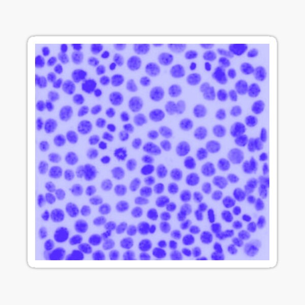 "Pastel purple nuclei in epithelial cells. Express yourself with ...