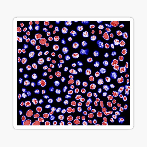 "Red white and blue nuclei in epithelial cells. Express yourself with ...