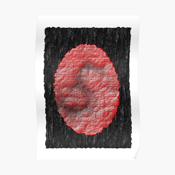 "Scab" Poster by MoMoJaJa | Redbubble