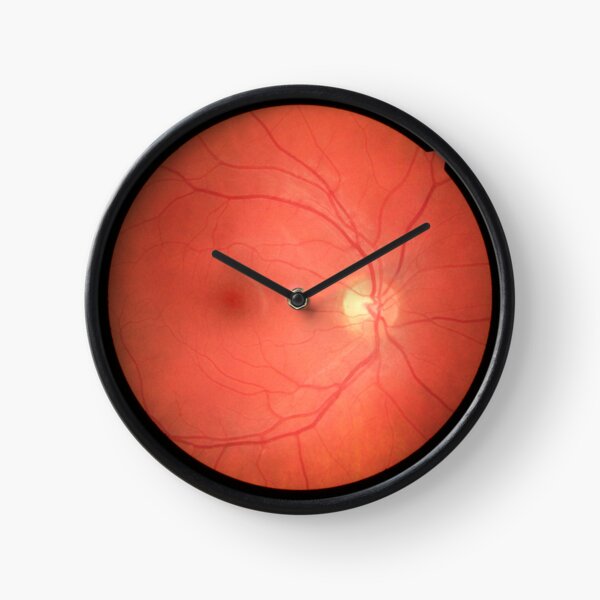 Retina Gifts & Merchandise for Sale | Redbubble