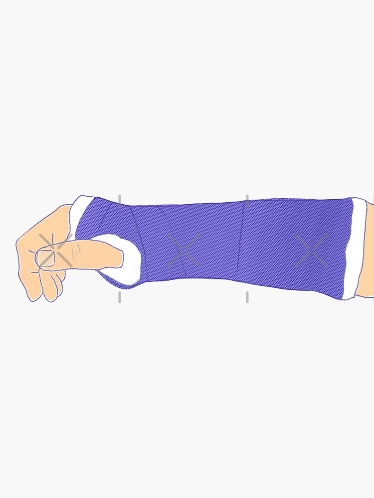 "Broken Arm Cast Illustration Sticker Clumsy Friend " Sticker for Sale ...