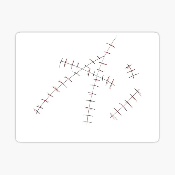 "Stitches" Sticker for Sale by Tonbbo | Redbubble