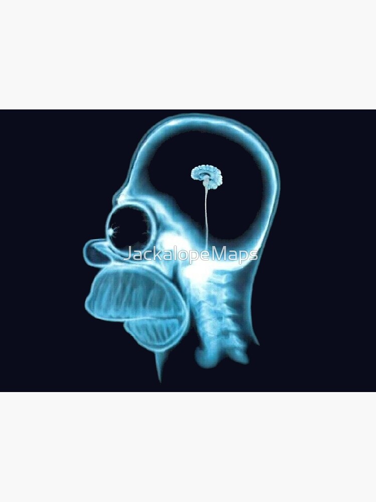 "" USA: 2022/present - X-ray of Homer's head ..." Poster by ...