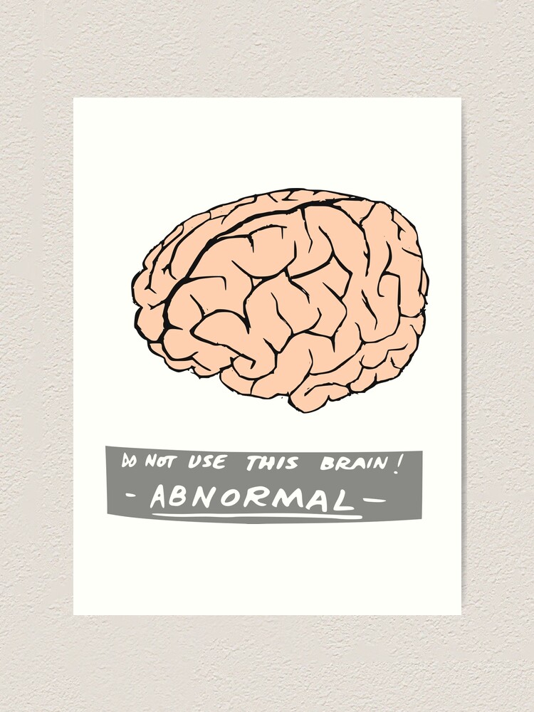 "Abby Normal (Young Frankenstein)" Art Print for Sale by patdavid ...