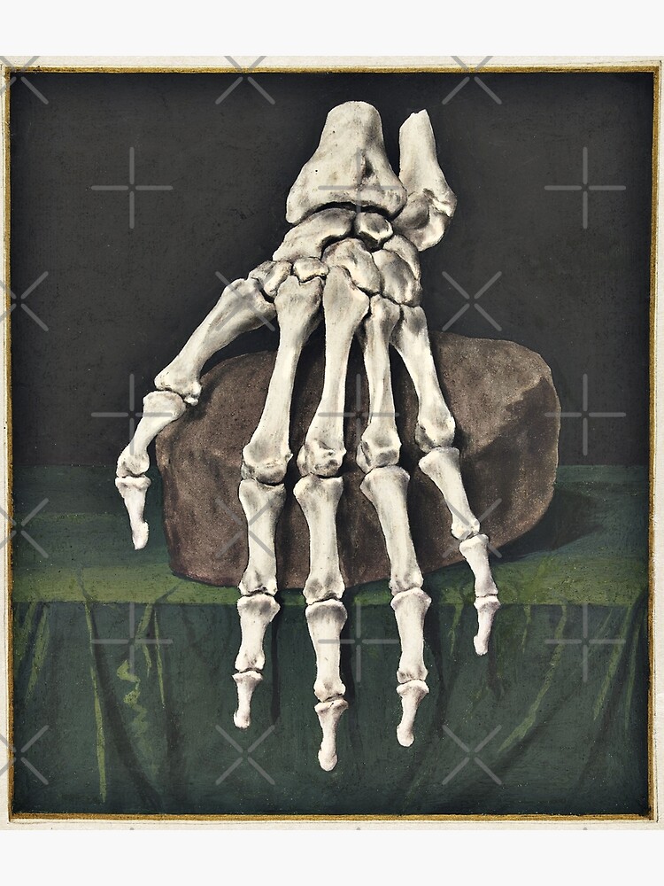"Skeleton Hand Vintage Anatomy 18th Century Print Art Gothic " Art ...