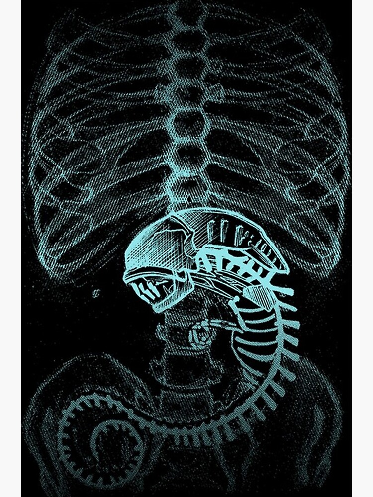 "Alien Radiography, X-Ray" Poster for Sale by ruthruffin | Redbubble