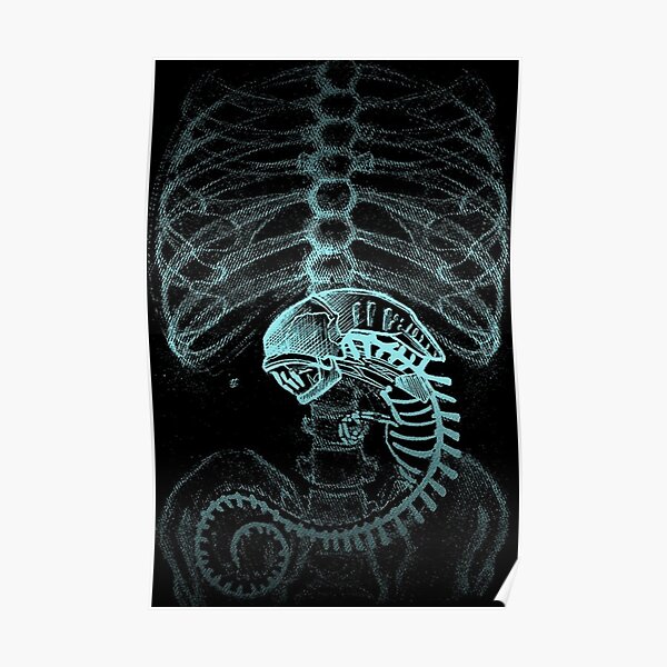 "Alien Radiography, X-Ray" Poster for Sale by ruthruffin | Redbubble
