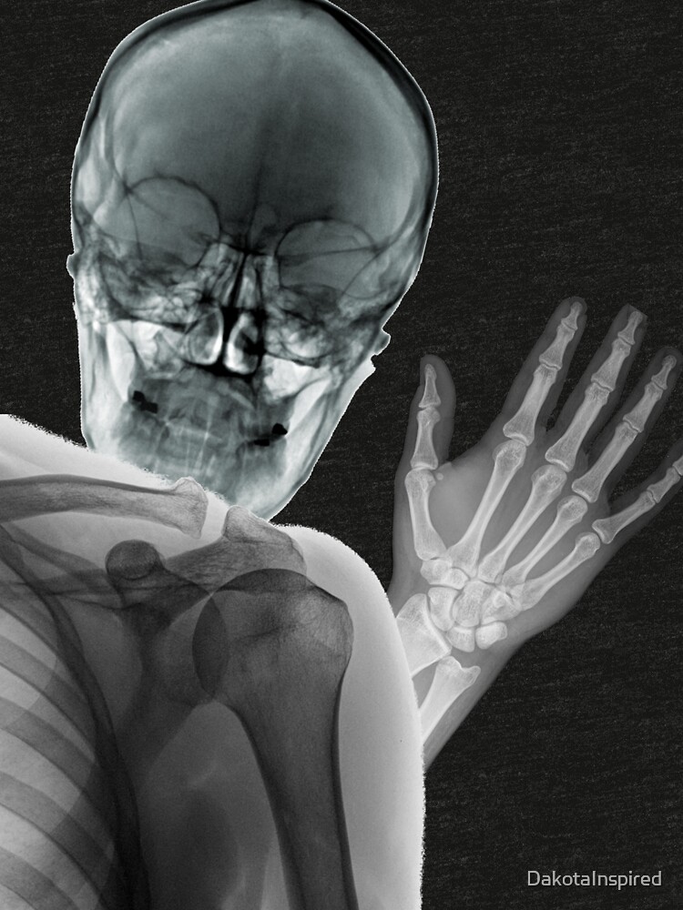 "Funny X-ray Photobomb" T-shirt by DakotaInspired | Redbubble