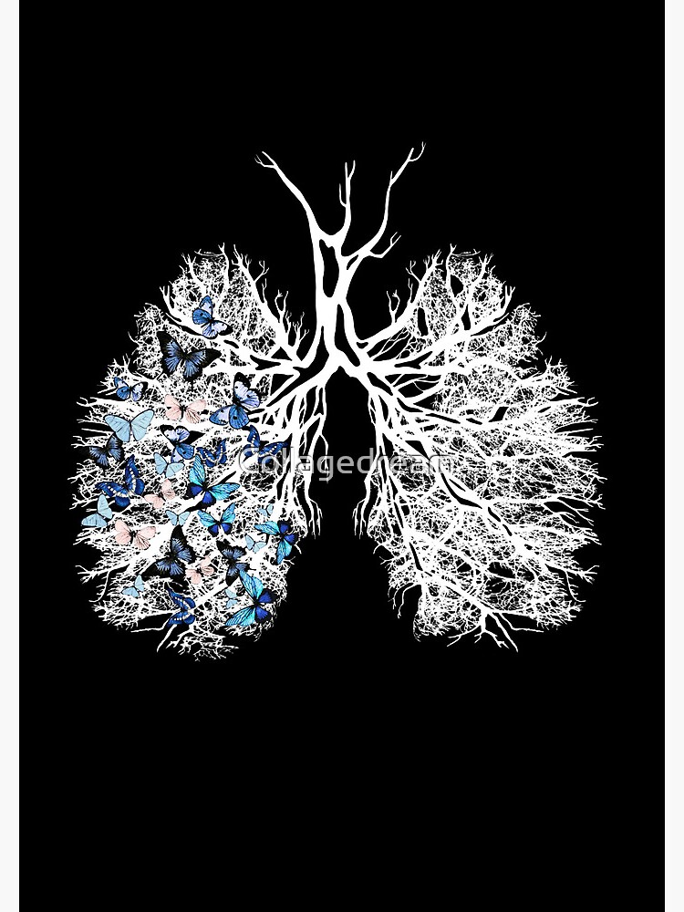 Cuaderno de espiral «Pulmones de árboles blancos como ramas, pulmón ...