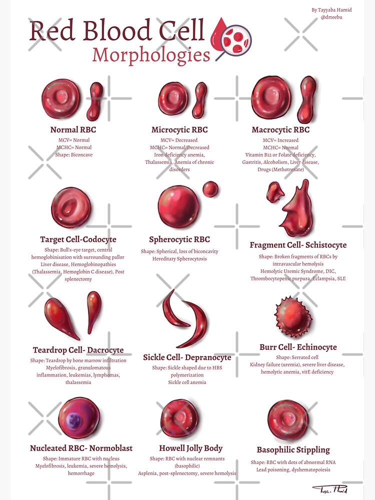 Red Blood Cell Morphology Mayo